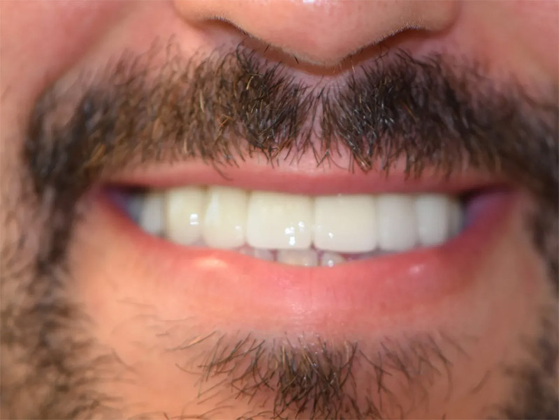 Charles Town Smiles Gallery in Charles Town, WV